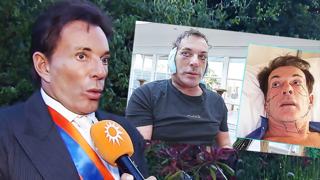 Gerard Joling duikt op met nieuw gezicht: fans in shock